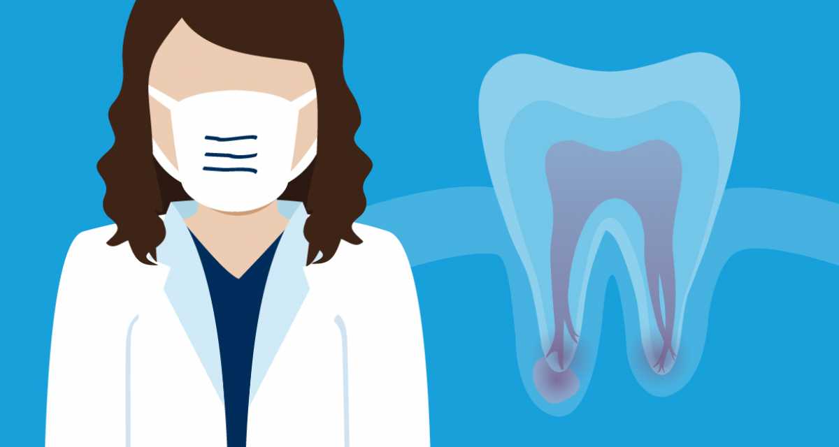 The Less Invasive Root Canal Alternative | The GentleWave® Procedure