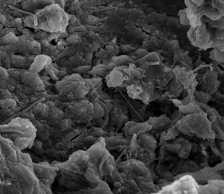 Root Canal Results Worth Talking About | GentleWave® Procedure